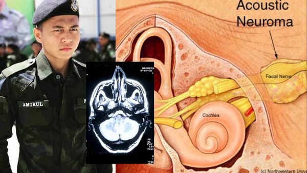 "Doktor Report I'm Free From Cancer!" - Lelaki Kongsi Tips Kecutkan ...