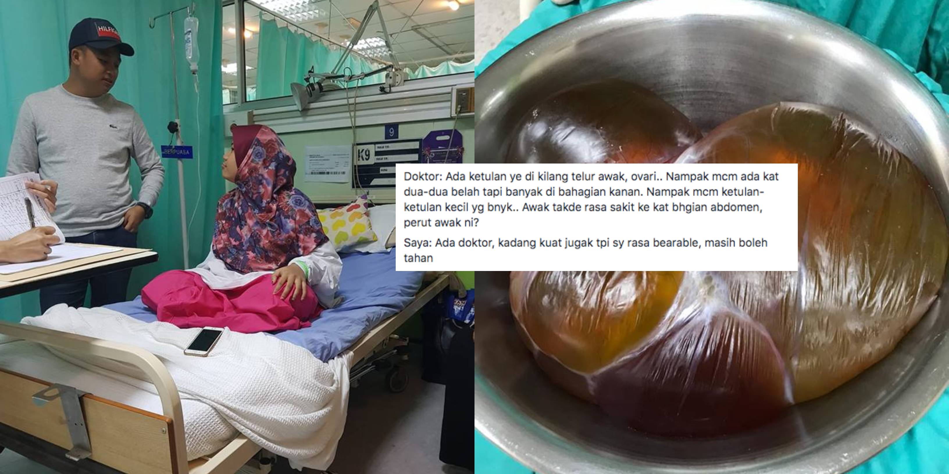 "Saya Tak Pregnant, Ada Kilang Telur Di Ovari" - Wanita Ini Kongsi ...