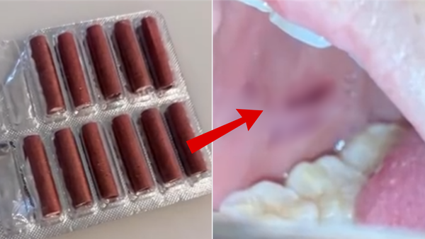 Firecracker Explodes In Woman's Mouth In China After Mistaking It For Candy