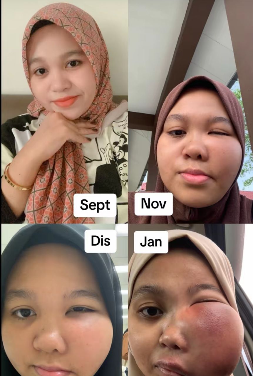 Suami Setia Jaga Isteri Sakit Barah Tulang - "Saya Tak Akan Biar Dia ...